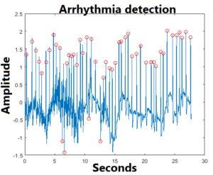 Ainigma Technologies – Artificial Intelligence for the optimization of ...